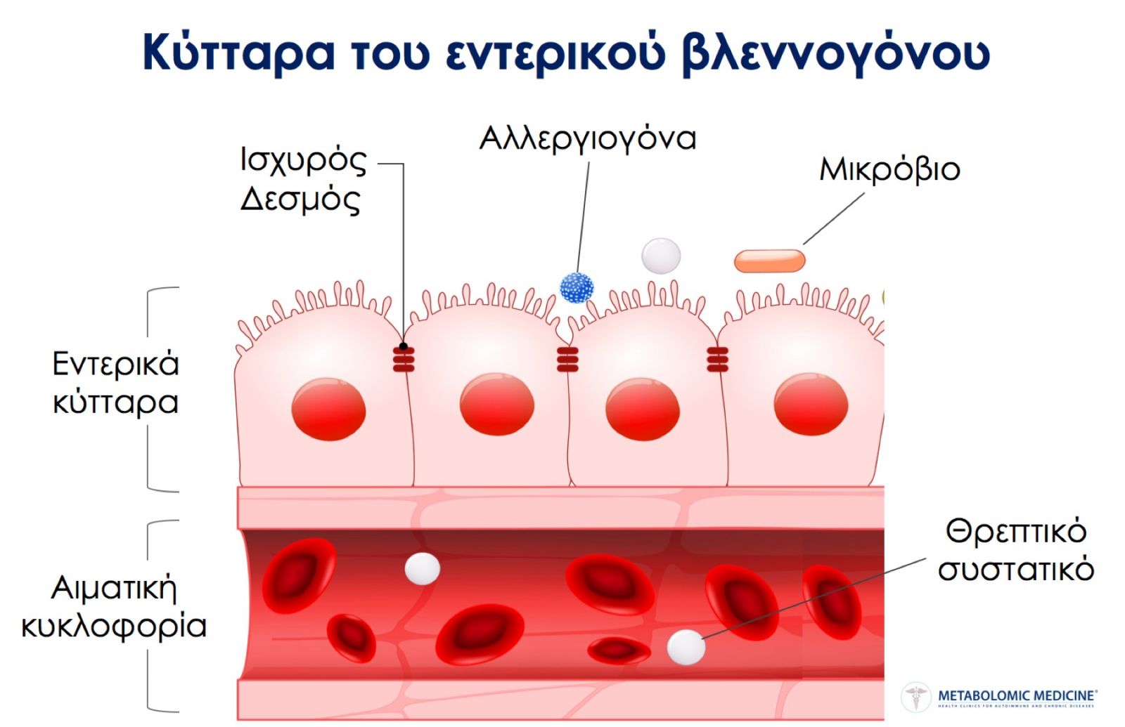 ευερέθιστο έντερο σπαστική κολίτιδα Dr Tsoukalas
